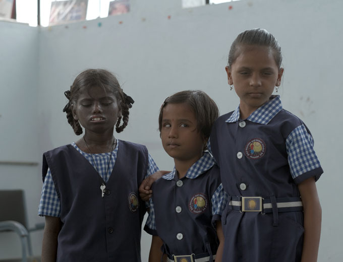 This Visually Impaired Professor Needs Your Help To Uplift 100 Visually ...