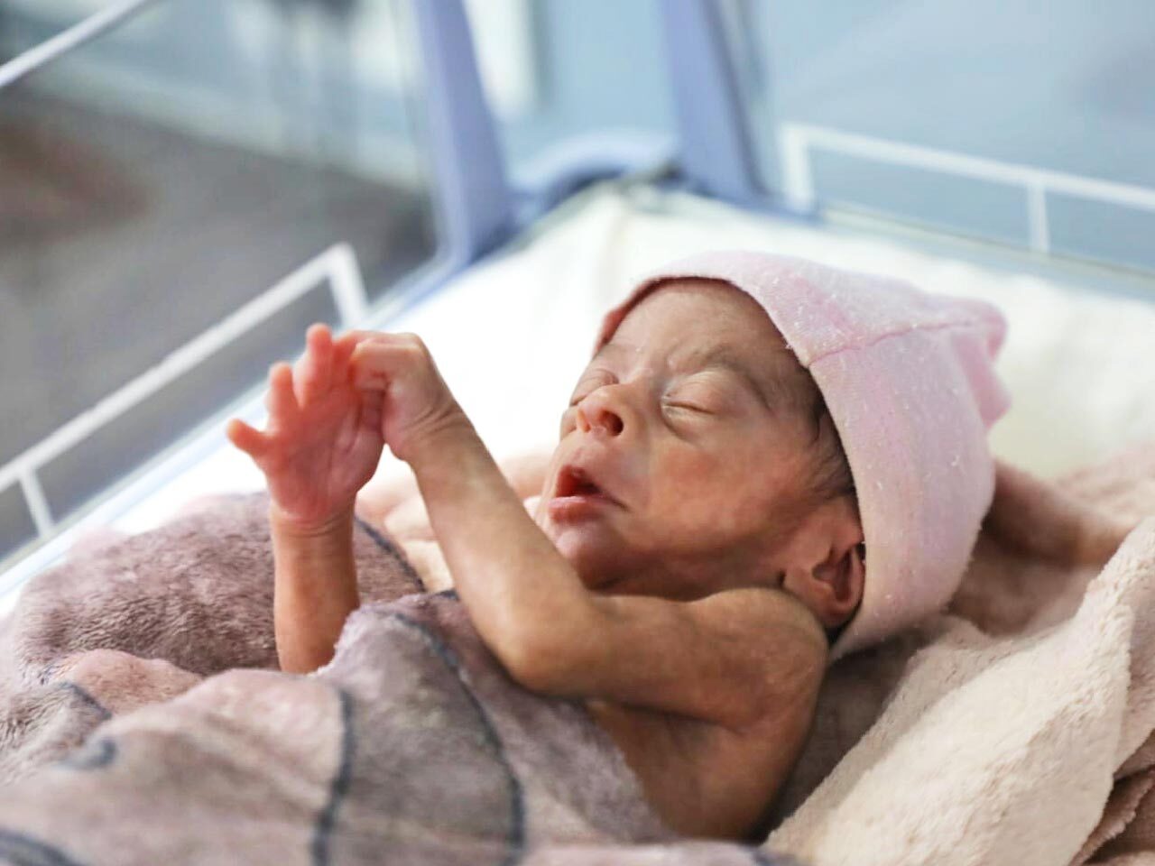 Every Second Counts, Preterm Baby Girl Needs Urgent Support to Survive ...