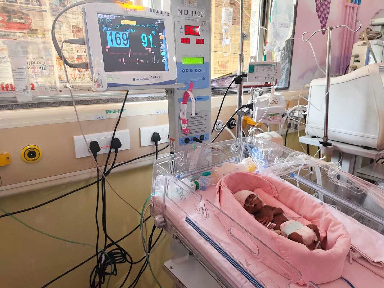 Devastated After Losing One Twin, These Parents Have Nothing Left To ...