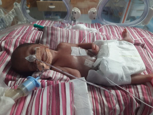 Baby of Mary Clancy and Anandaraj is in NICU, Please Show Your Support ...